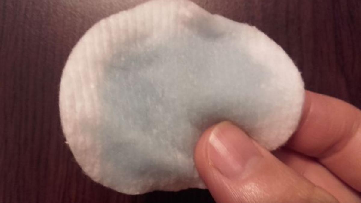 A turnat apă de gură pe un tampon de vată și l-a pus subraț. Uite ce s ...