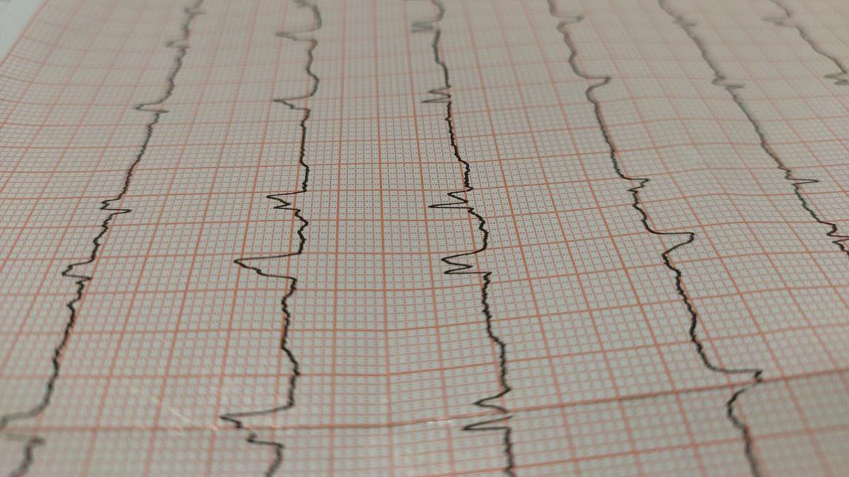 Motivul pentru care tot mai mulți tineri fac infarct. Dr. Alice ...