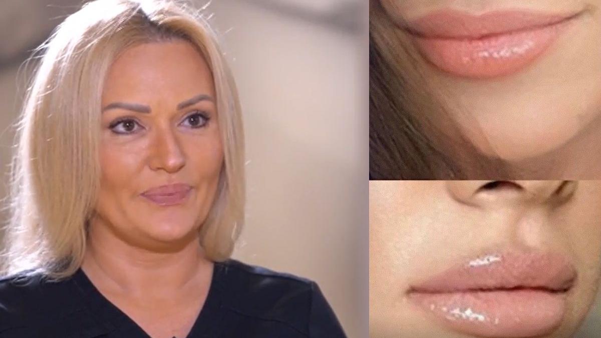 Intervenţiile estetice recomandate în sezonul rece. Dr. Nico Ferariu ...