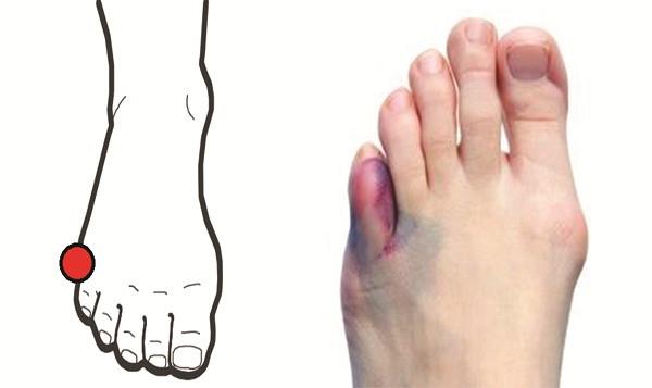 Adevarul despre durerea uriasa pe care o simti cand te lovesti la cot ...