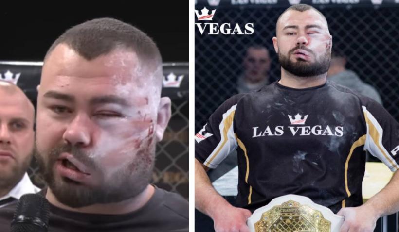 Galerie Foto - El este bărbatul care s-a lăsat desfigurat pentru 5.000 ...