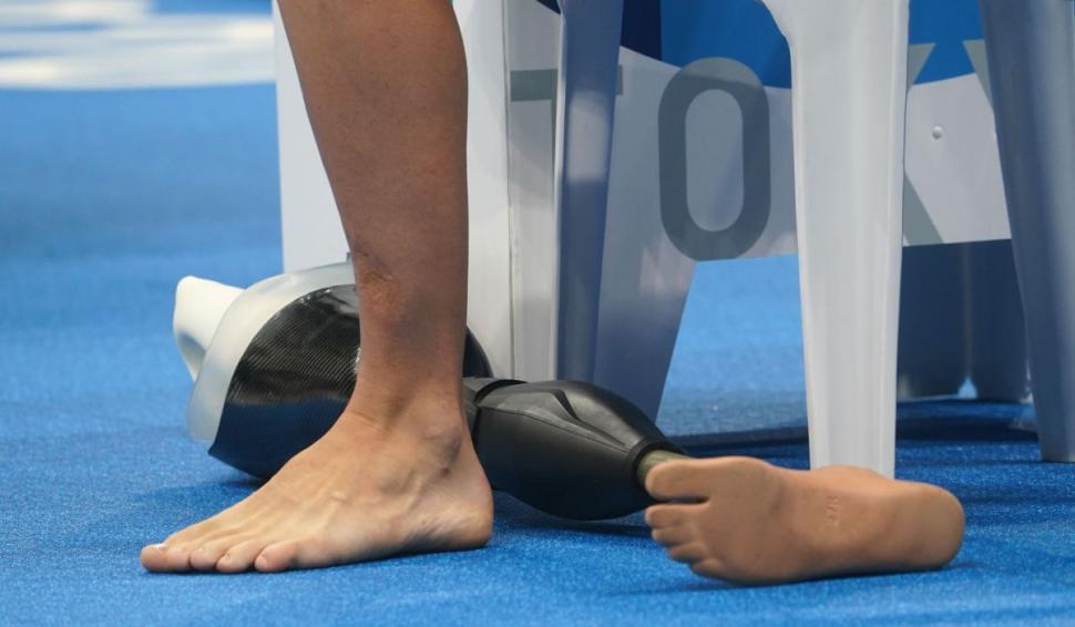 Un pacient din Spania, căutat de spitalul care i-a amputat piciorul ...