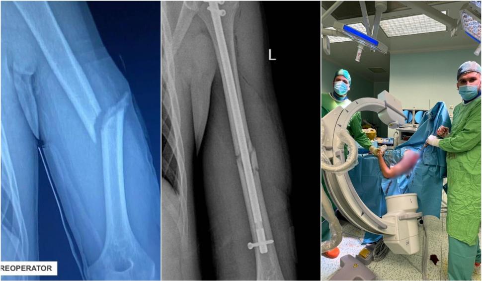Operație în premieră la Oradea, în cazul unui adolescent rănit grav ...