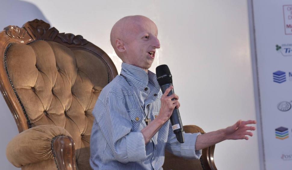 Sammy Basso, om de ştiinţă şi simbol al luptei împotriva progeriei ...