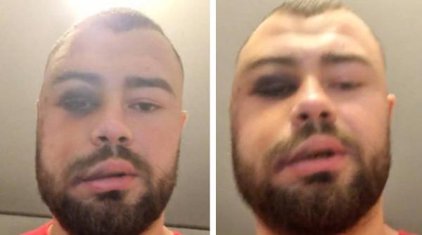 El este bărbatul care s-a lăsat desfigurat pentru 5.000 de euro, la un ...