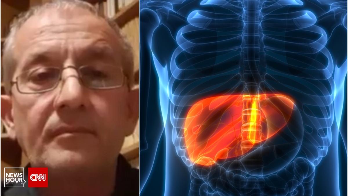 Dr. Cătălin Apostolescu explică diferenţa dintre hepatita misterioasă ...